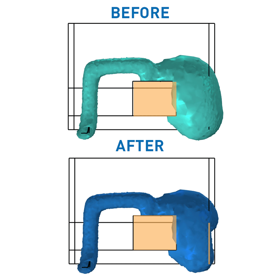 magnetic shielding of a transformer station.